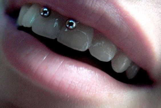 The smiley piercing: Healing and Aftercare Guide & FAQs Answered - VeAn ...